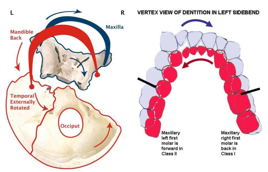 Craniofacial Development: Malocclusion Is Just A Symptom – TMD – Occlusion