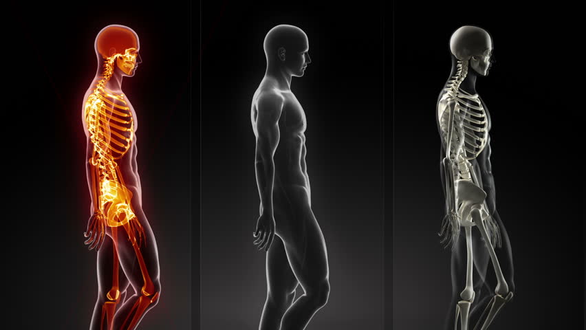 Body Posture: Alignment Is The Key for Health – TMD – Occlusion