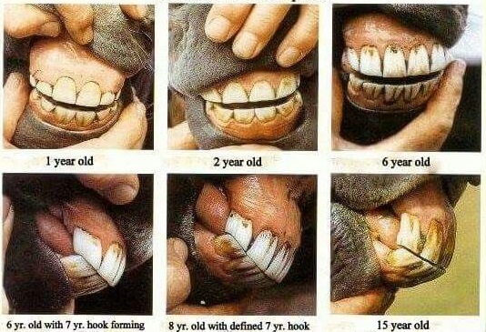Teeth: The Mirror of Body’s Health – TMD – Occlusion