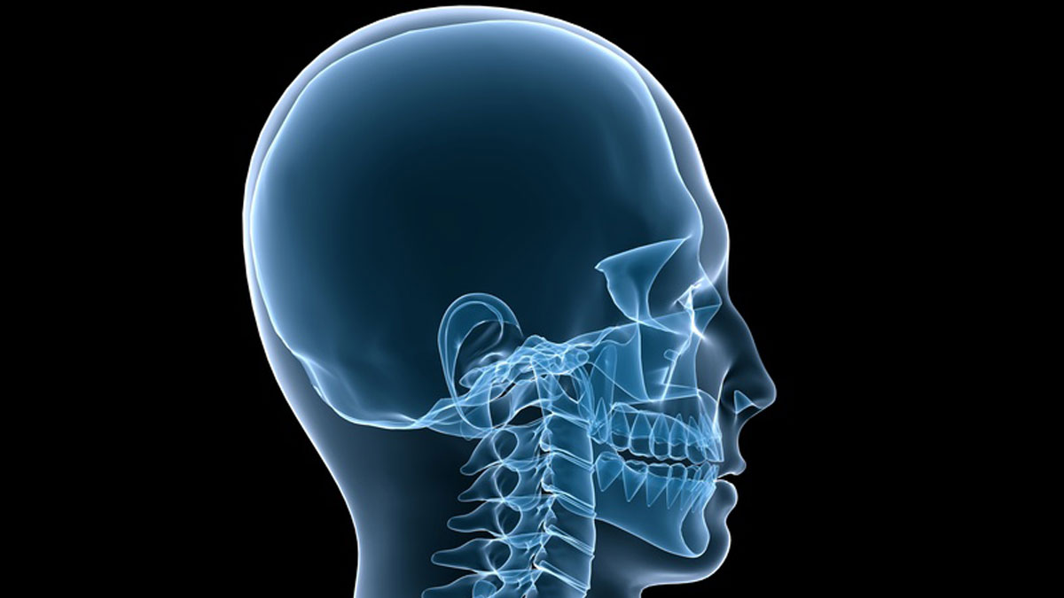 Temporomandibular Joint Dysfunction (TMD) – TMD – Occlusion