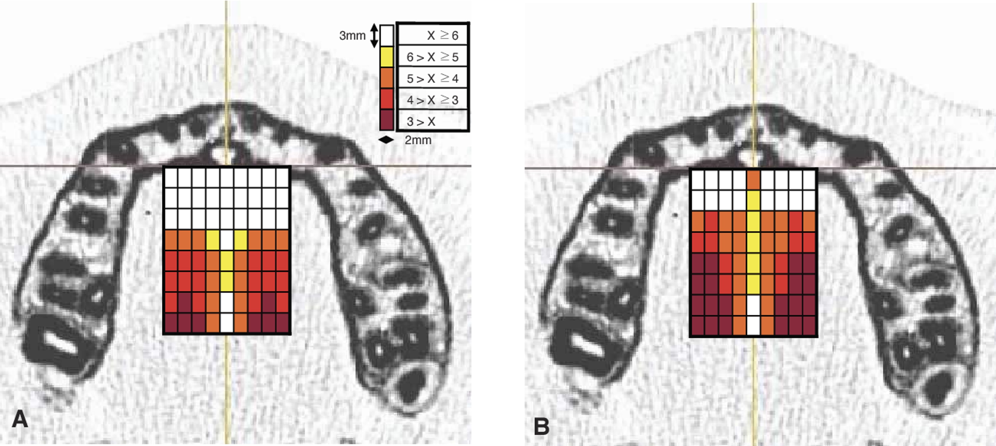 RPE/RME vs MARPE/MSE/EASE vs SARPE/DOME – TMD – Occlusion