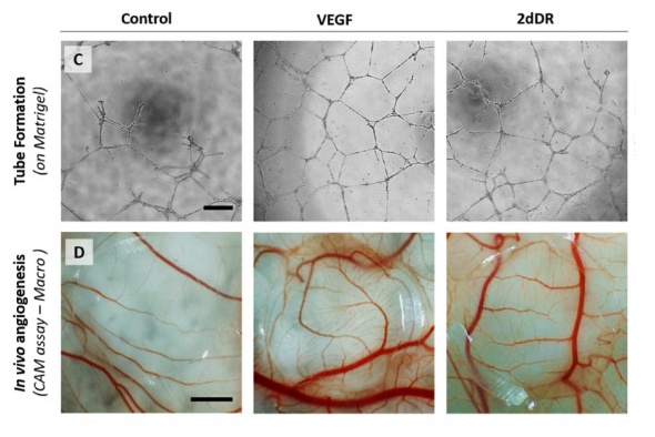 A Sugar Gel, Blood Supply and Hair Regrowth – TMD – Occlusion